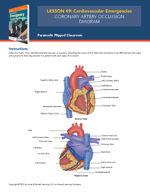 Lesson 49 Heart Failure Diagram - Paramedic Flipped Classroom LESSON 49 ...