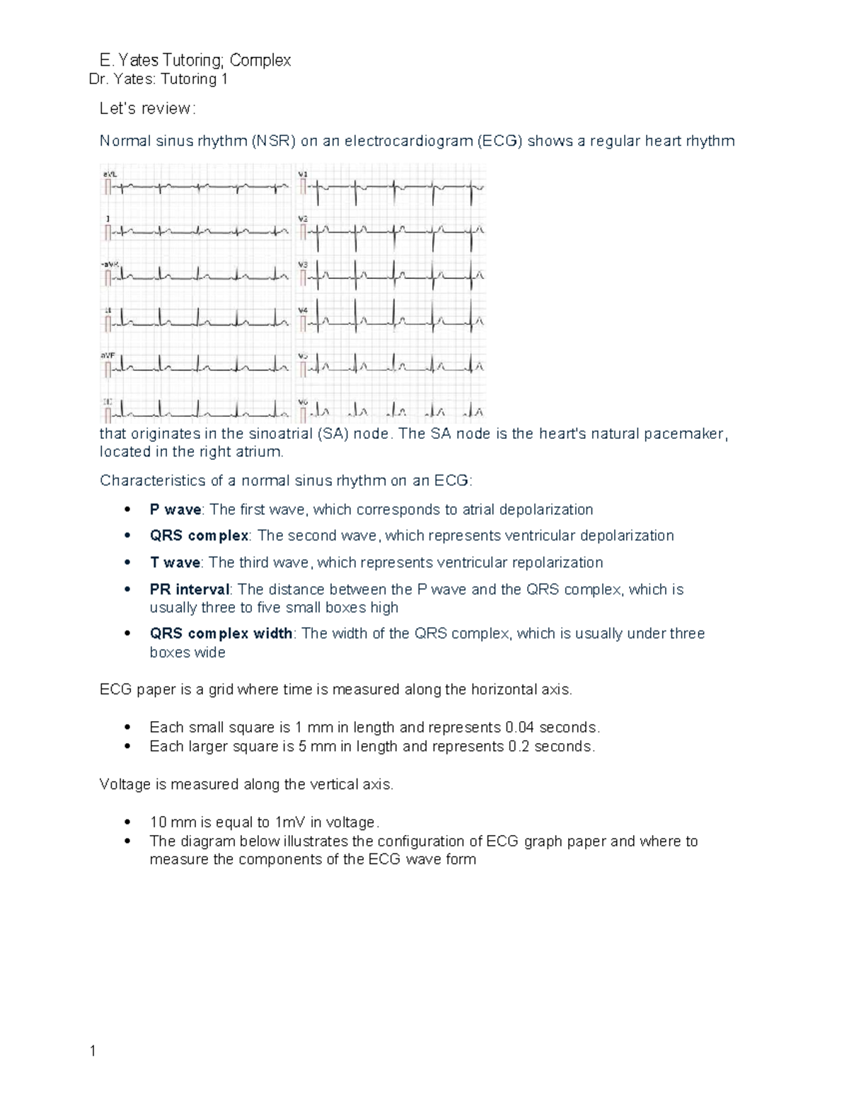 NUR4764 Final Exam Review: Normal Sinus Rhythm & Myocardial Infarction ...