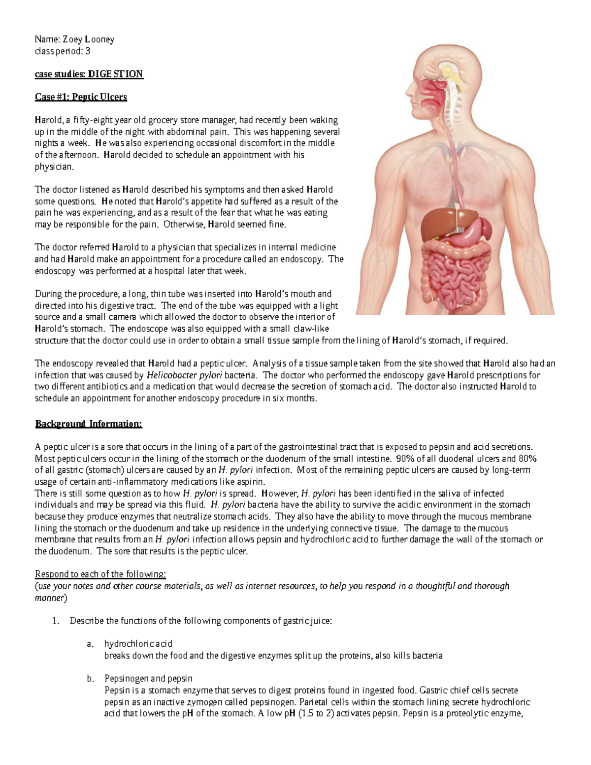 Case Studies Digestion - Google Docs - Name: Zoey Looney class period ...