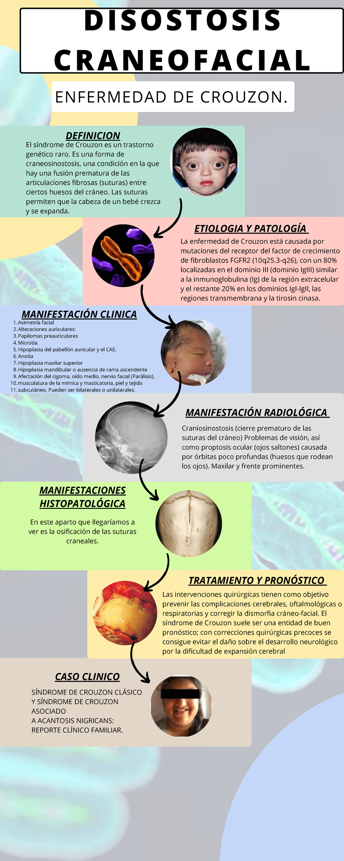 Infografía sobre el Síndrome de Crouzon: Definición y Tratamiento - Studocu