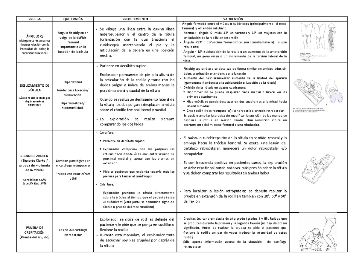 Prueba de Maniobras Especiales para la Rodilla: Evaluación y ...