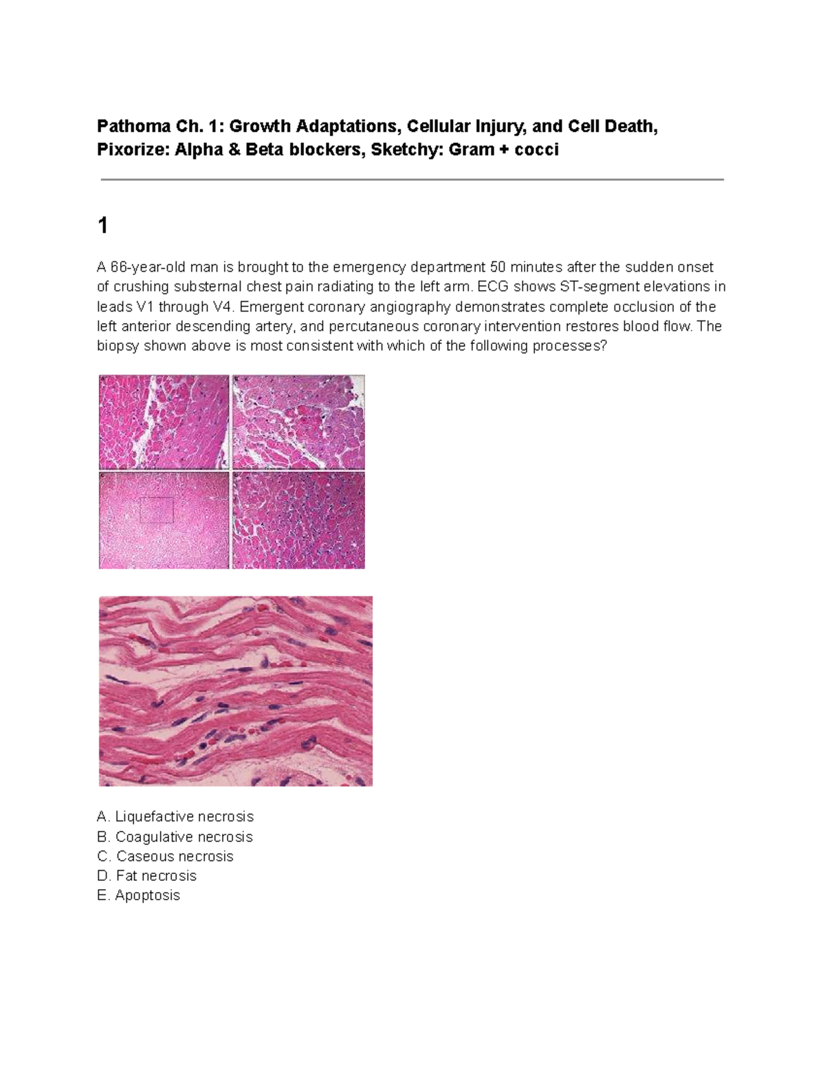 Pathoma Ch. 1 & Pixorize: Growth Adaptations & Cellular Injury Practice ...