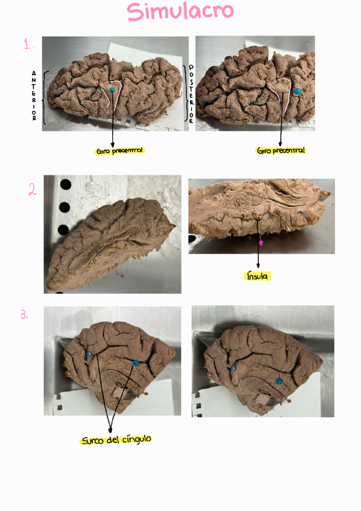 EC2 SIMULACRO SEM 11 - Morfofisiología IV - Simulacro 1 P A 0 N T S E T ...