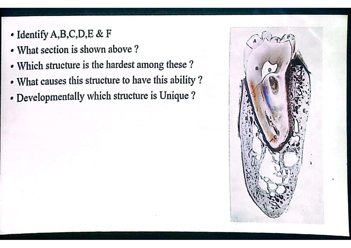 OSPE Questions for Oral Biology - Course Code 3 - Studocu