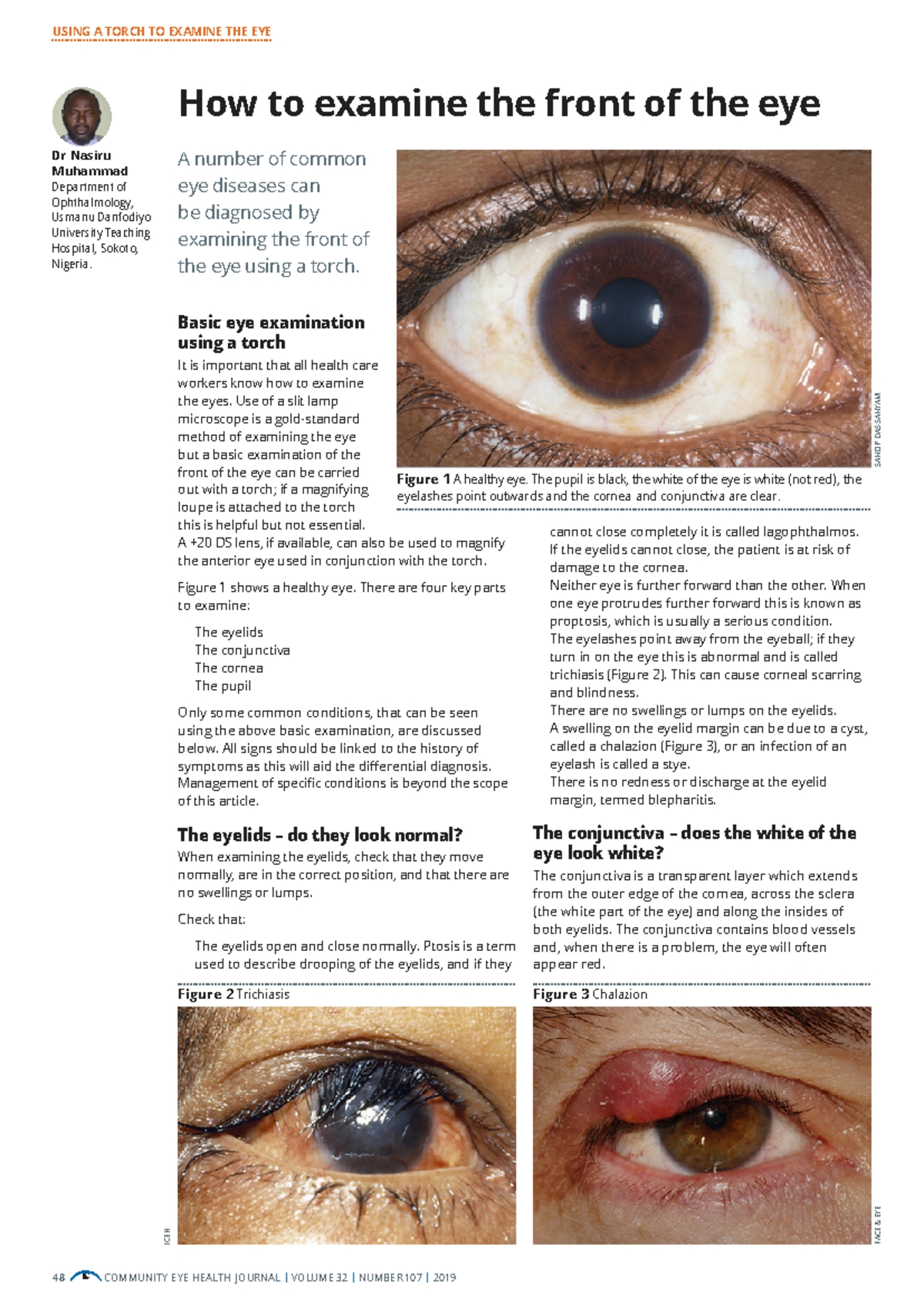 Basic Eye Examination Using a Torch: A Guide for Healthcare Workers ...