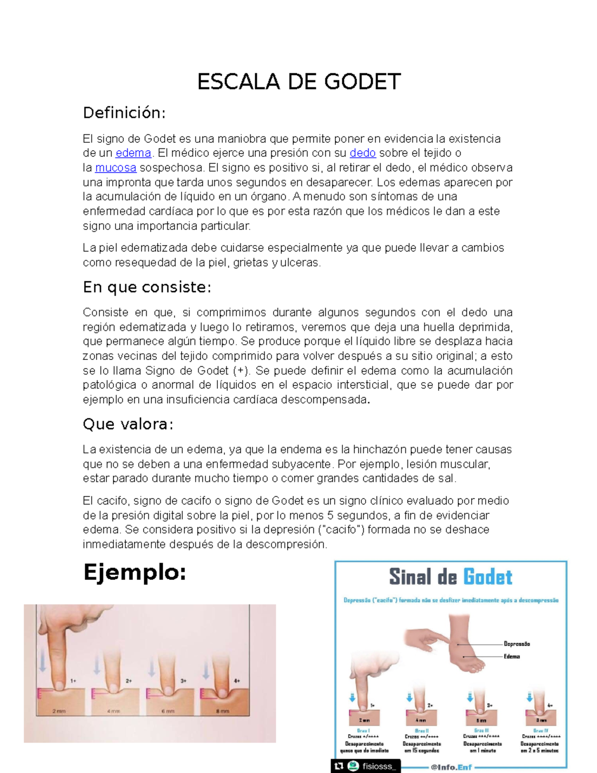 Signo de Godet: Evaluación del Edema y su Importancia Clínica - Studocu