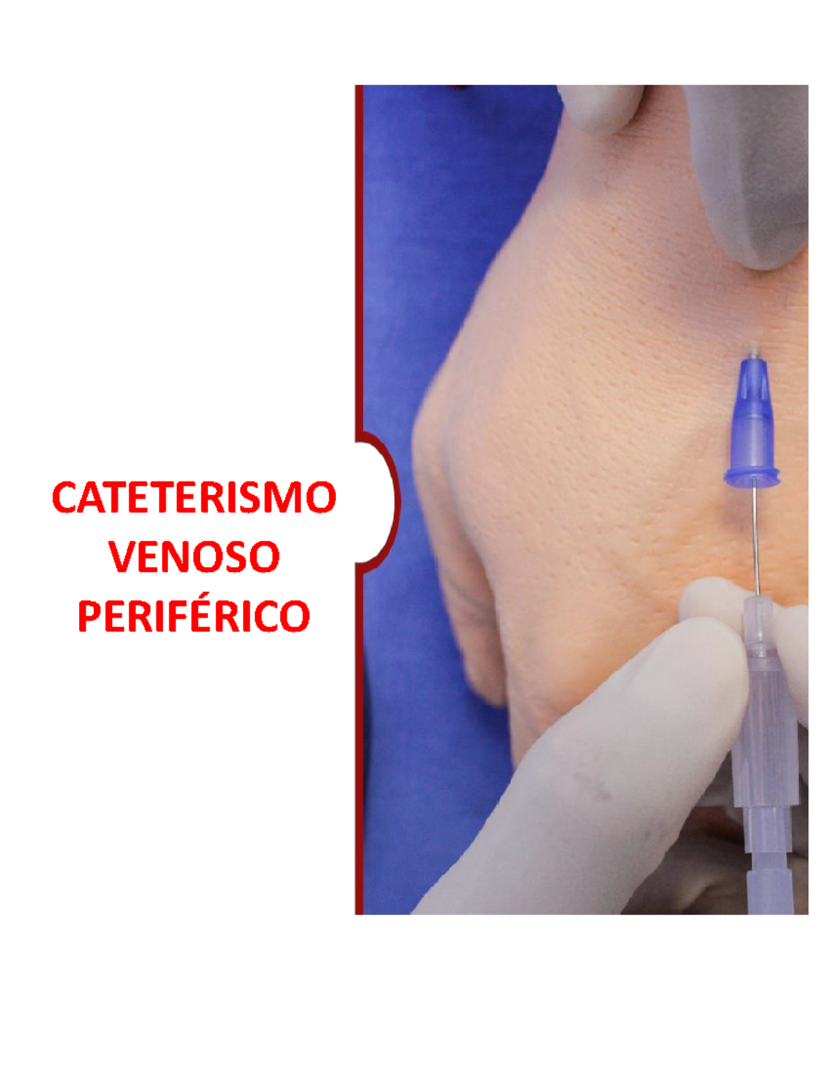 Técnicas de Cateterismo Venoso Periférico en Medicina (MÉD 101) - Studocu
