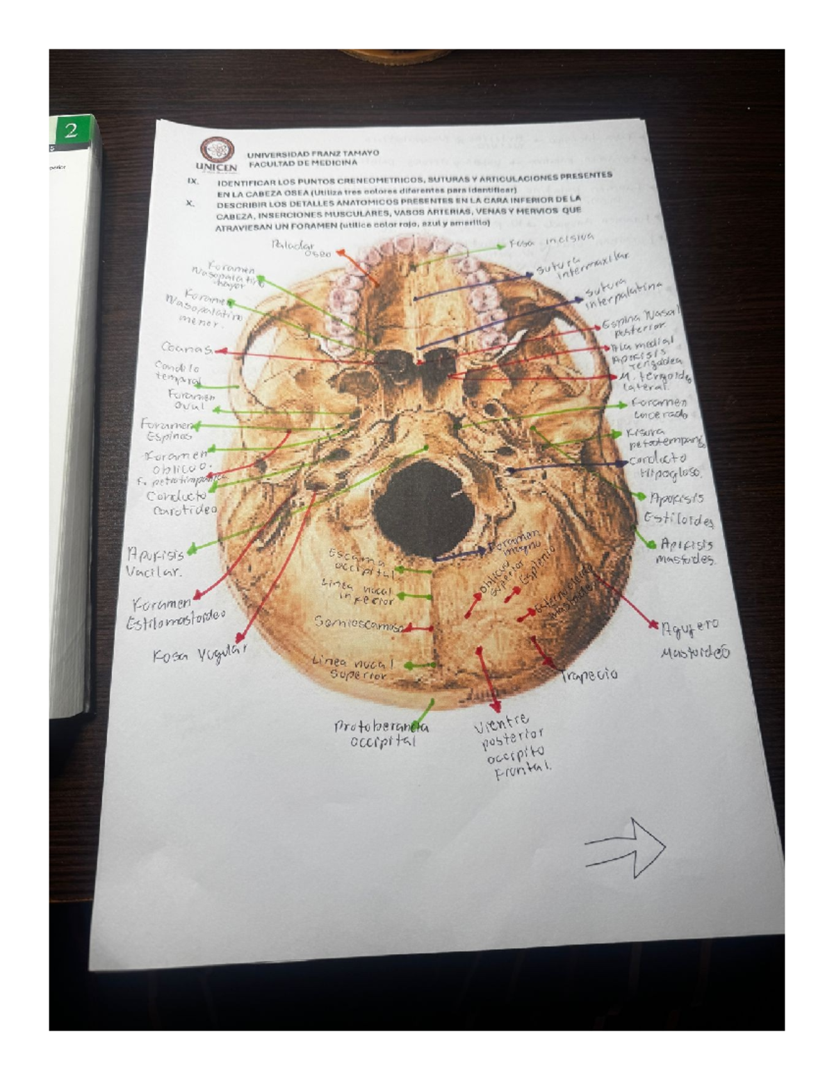 Anatomía de la Cabeza Ósea: Puntos Craneométricos y Detalles Anatómicos ...