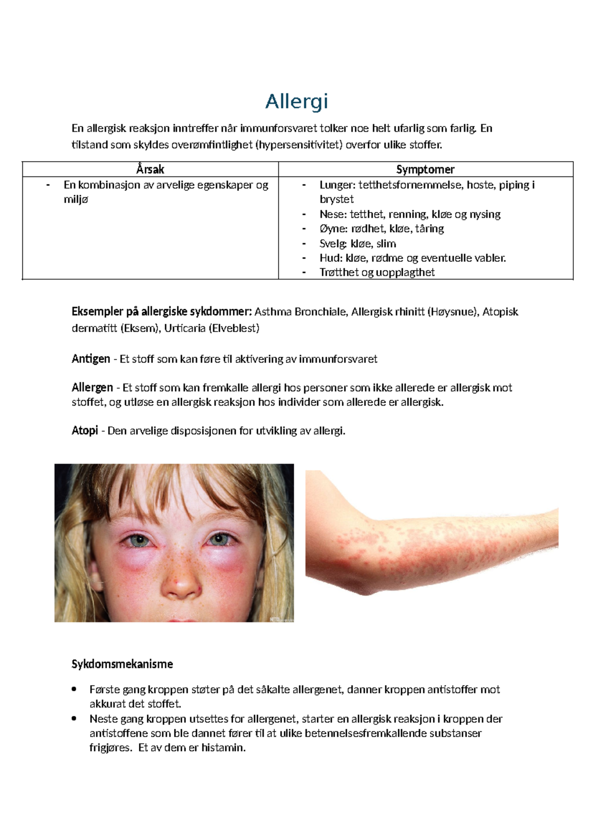 Allergi: Årsaker, symptomer og behandlingsmetoder - Studocu
