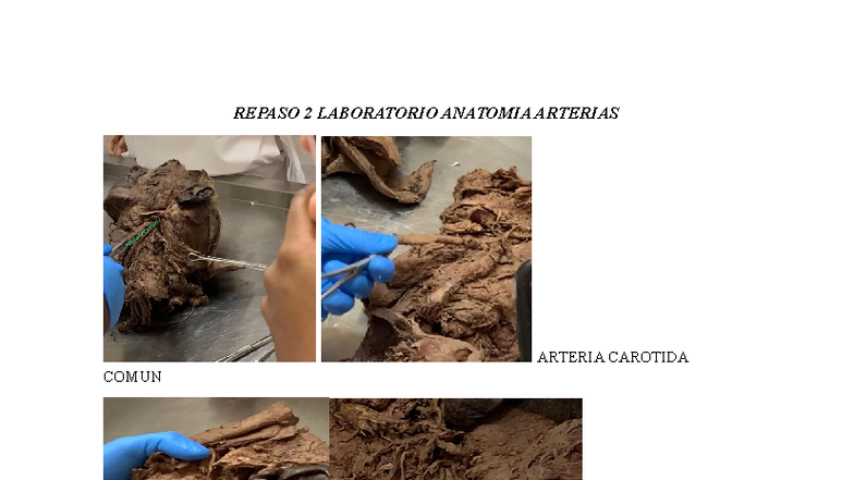 Repaso 2: Anatomía de Arterias y Venas en Laboratorio - Studocu