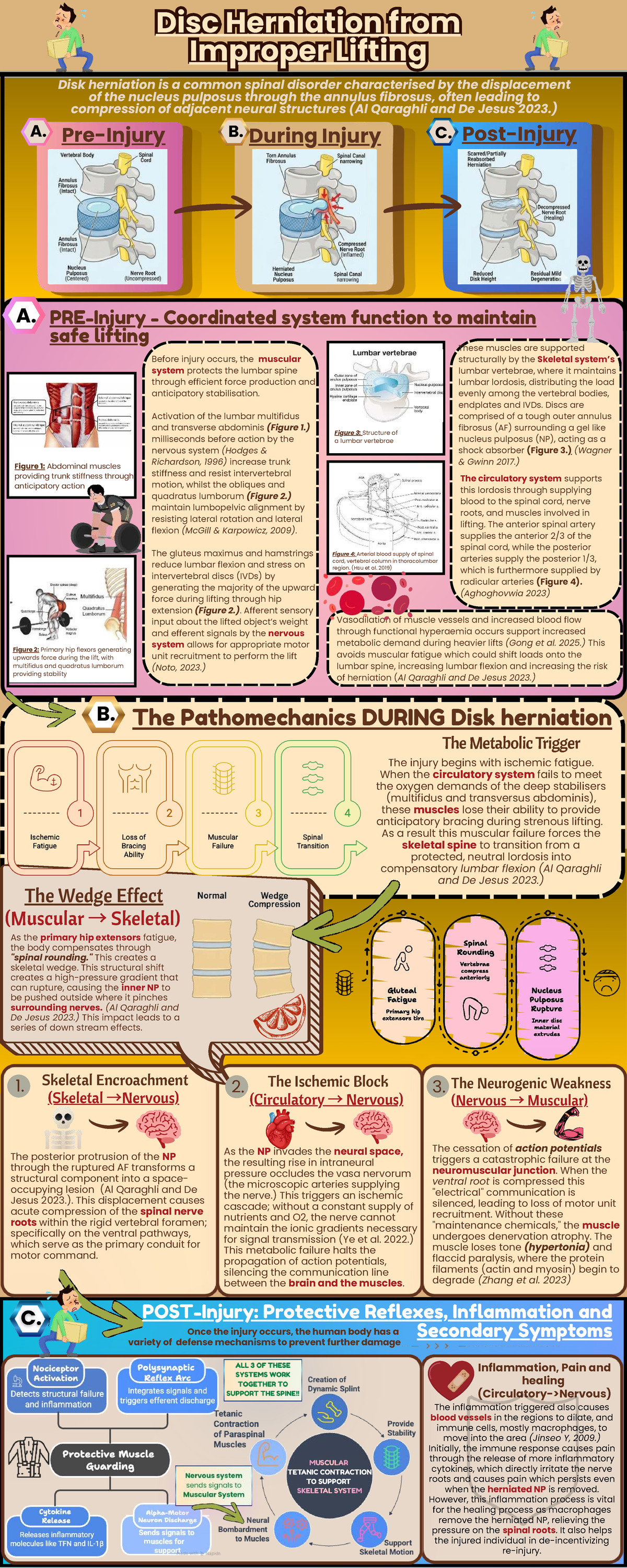 Infographic on Disc Herniation: Causes, Effects, and Recovery - Studocu
