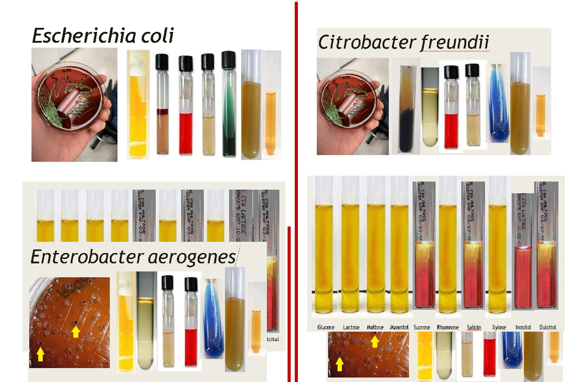 Enterics Demonstration SET UP - Escherichia coli Citrobacter freundii ...