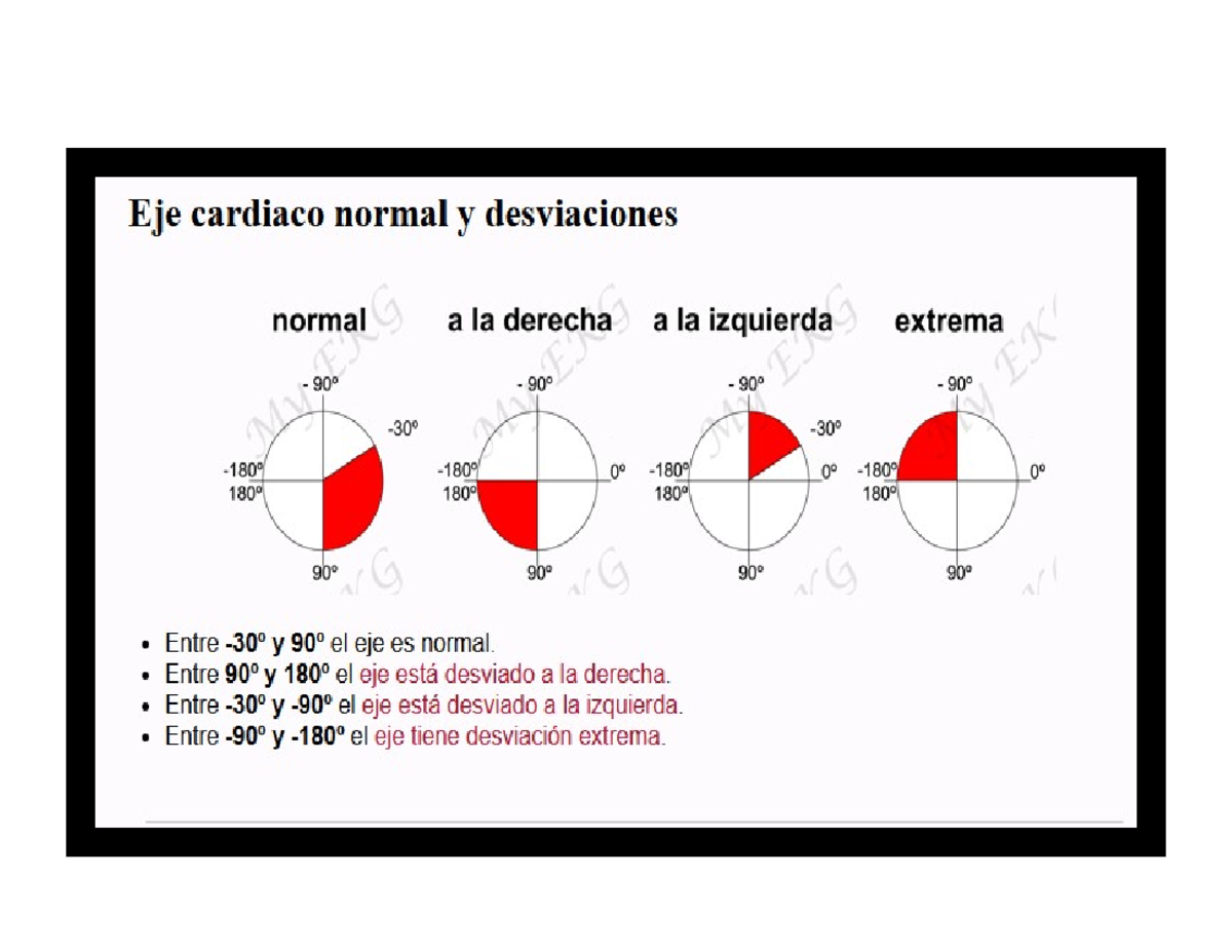 Eje cardiaco - Cardiologia - Entre y el eje está desviado a la derecha ...