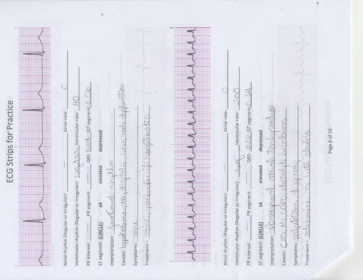 ECG Practice Strips Analysis for ECC 204: Atrial Rhythms and ...