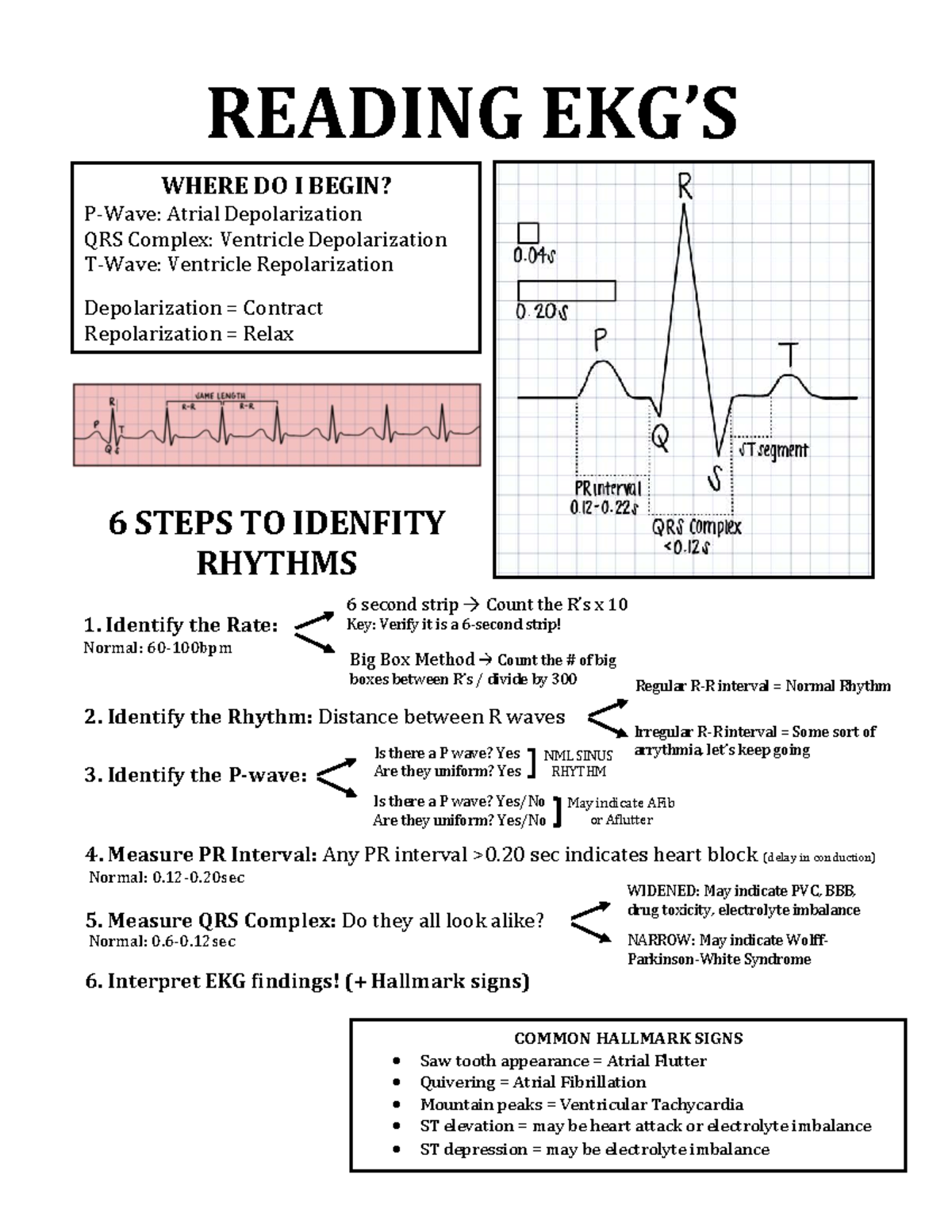 EKG Interpretation Guide: Identifying Rhythms & Heart Conditions - Studocu