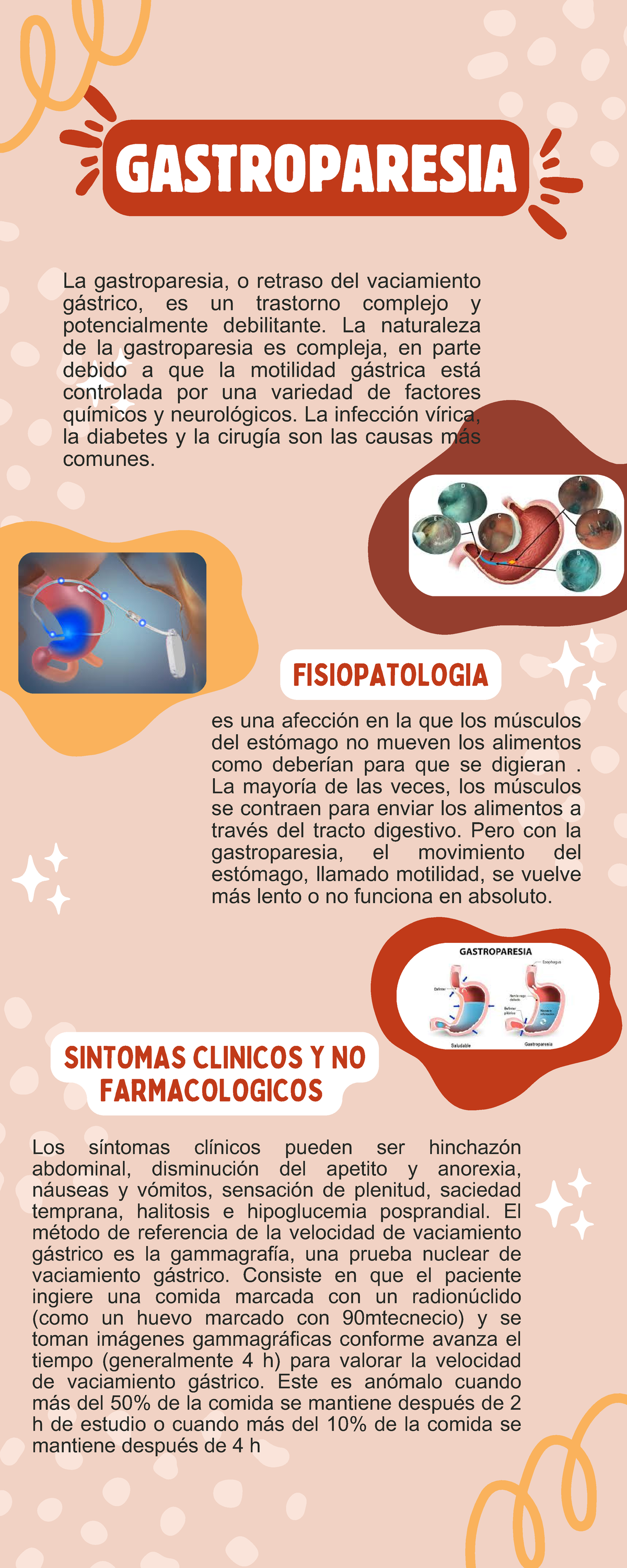 infografía gastroparesia - GASTROPARESIA Los síntomas clínicos pueden ...