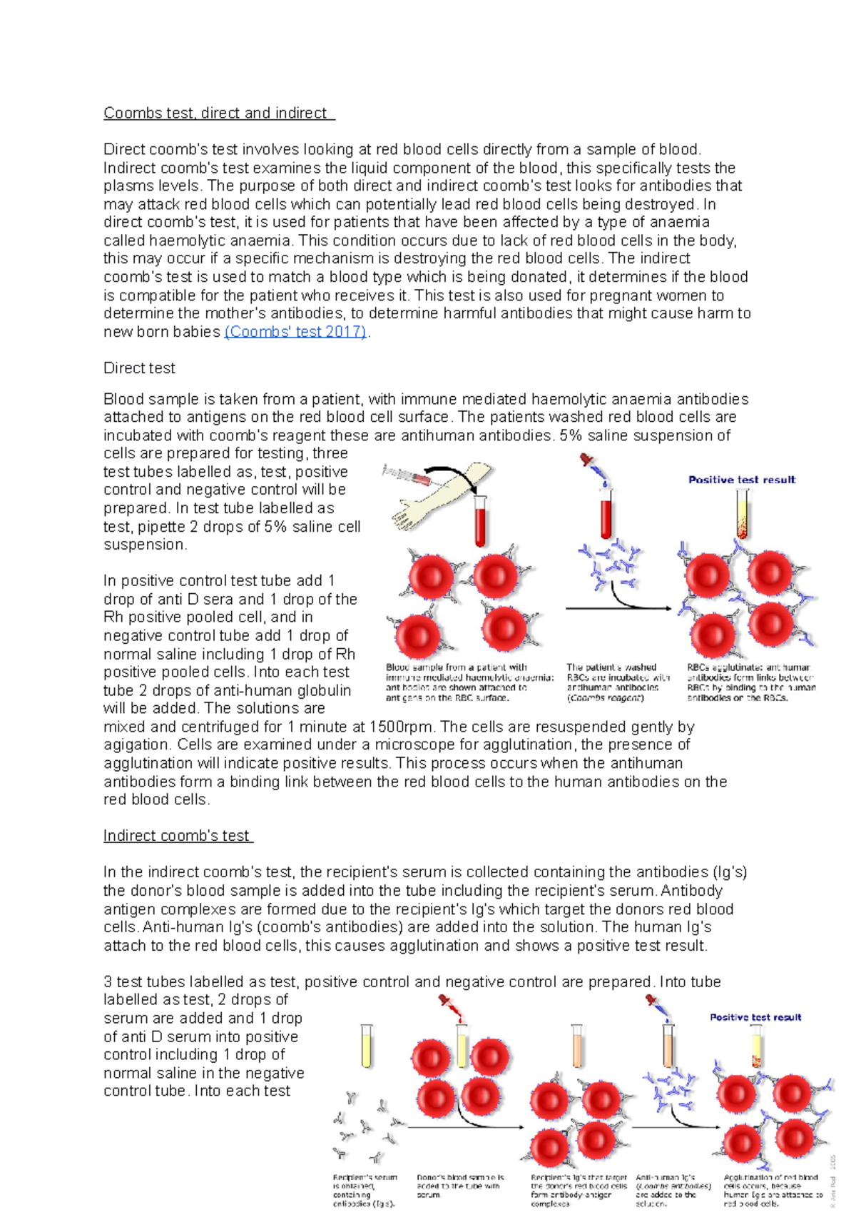 Coombs test summaries - Revision notes - Coombs test, direct and ...