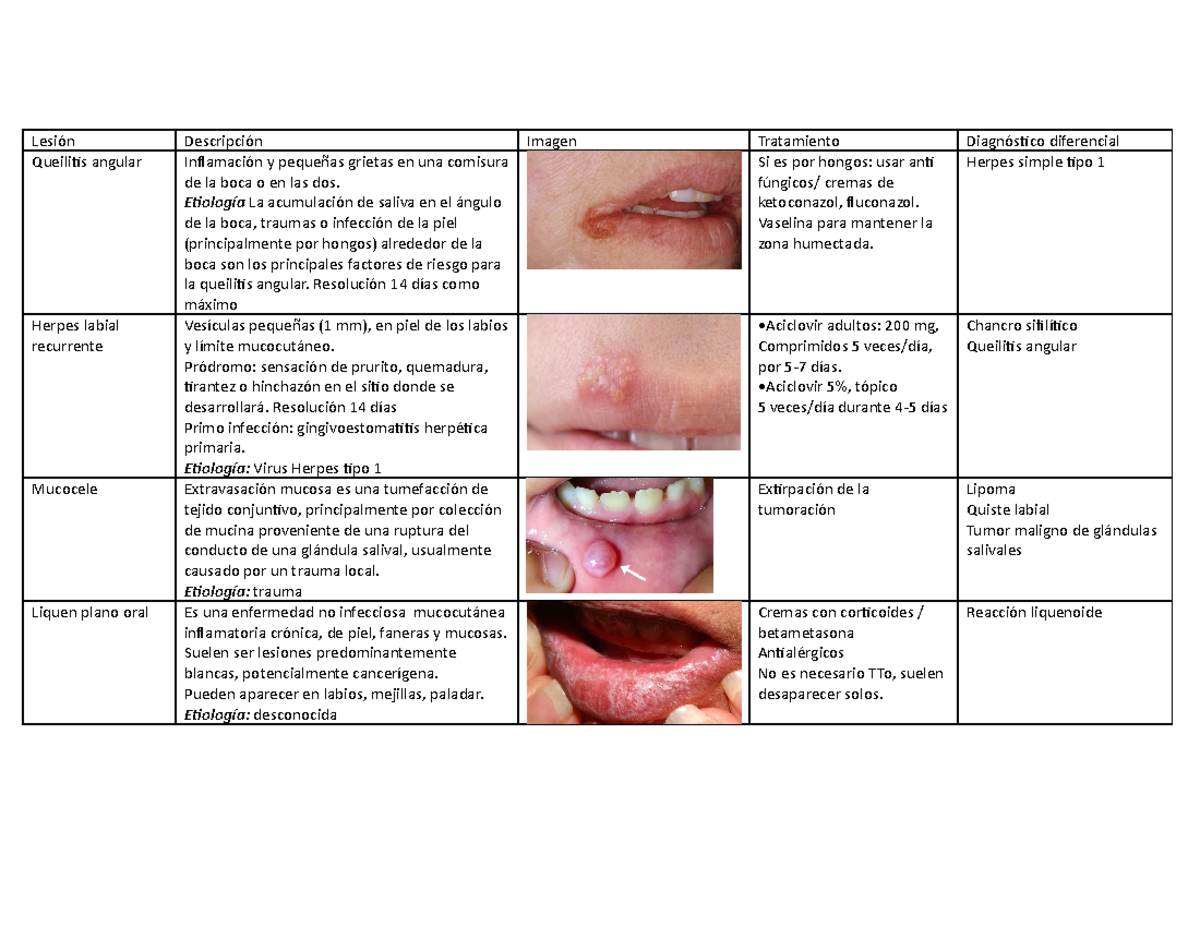 Queilitis Infecciosa Diagnostic And Therapeutic Procedures Followed