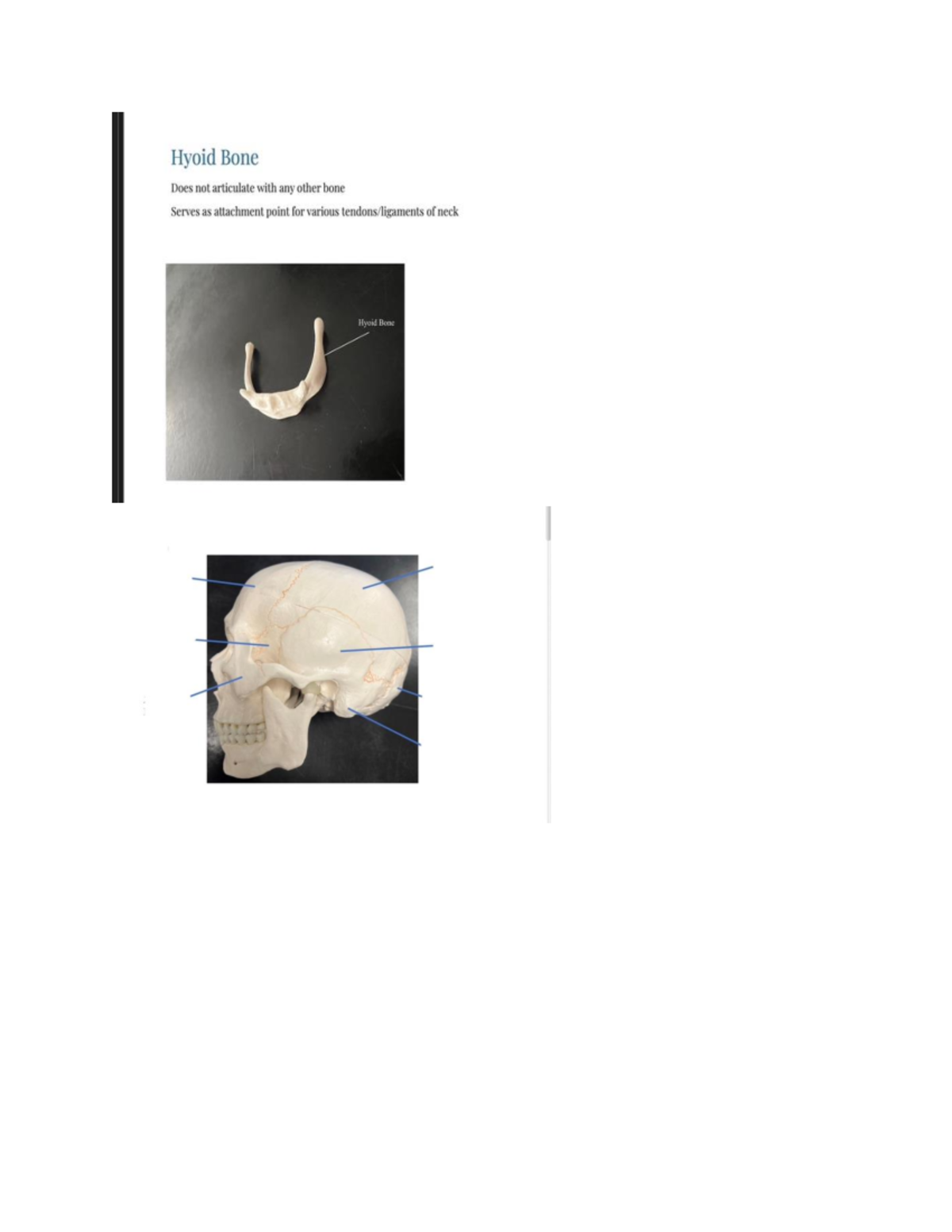 Document 2 - blank diagrams - BIOL 243 - Hyoid Bone Does not articulate ...