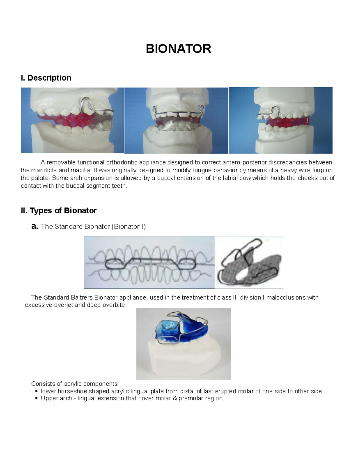 Definition, Use, Advantages of Bionator in Orthodontics Definition, Use ...