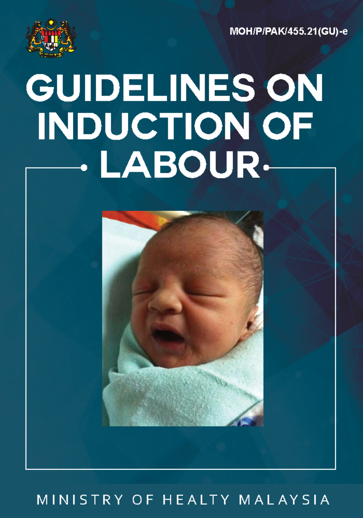 Guidelines on Induction of Labour (IOL) - Ministry of Health Malaysia ...