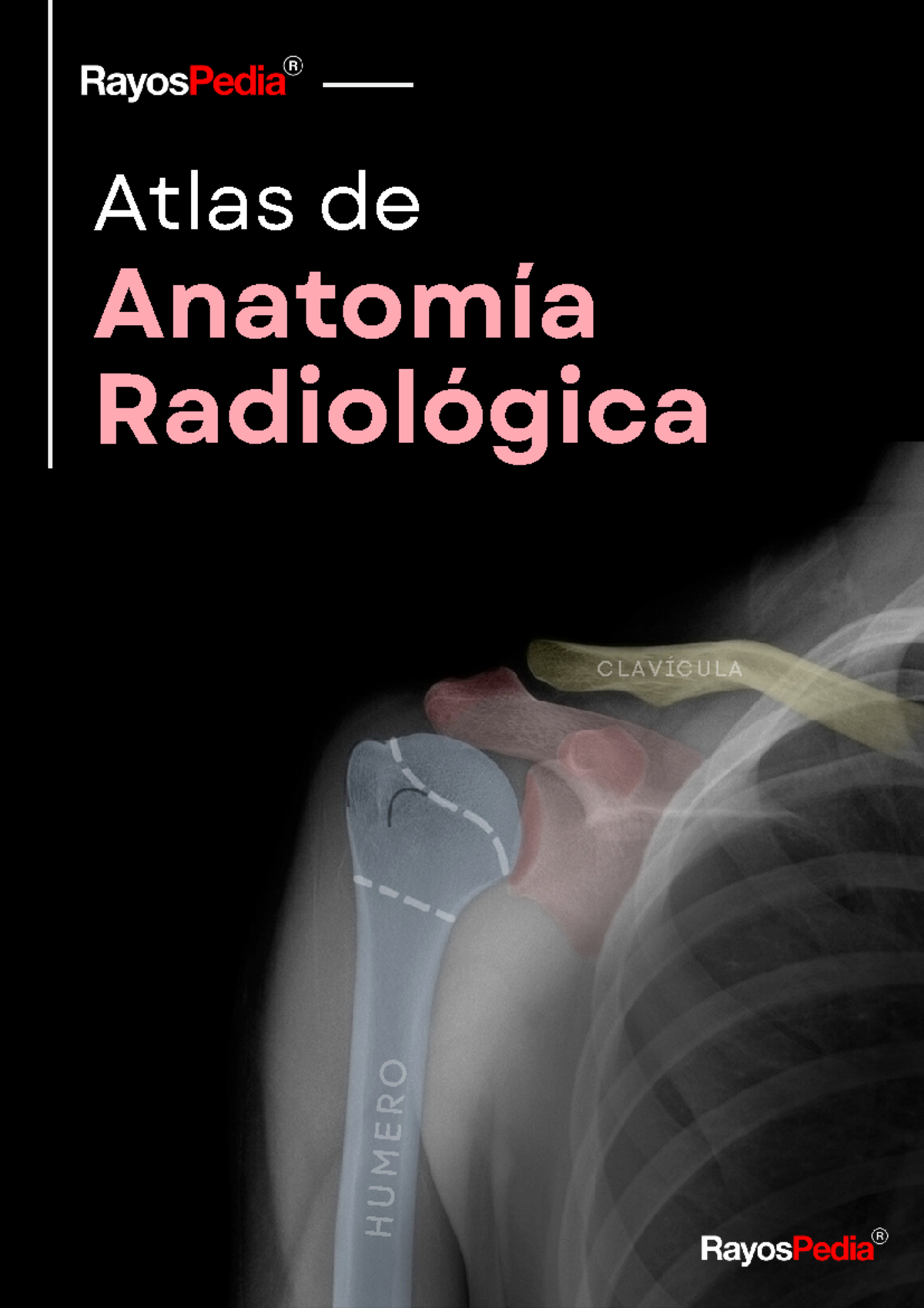 Atlas de Anatomía Radiológica: Radiopedia Libro de Imágenes - Studocu