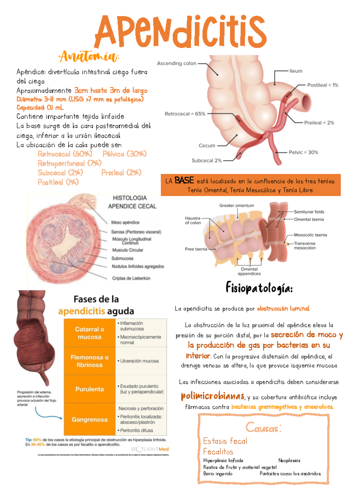 Apendictis (resumen) - Apendicitis ####### Anatomía: Apéndice ...