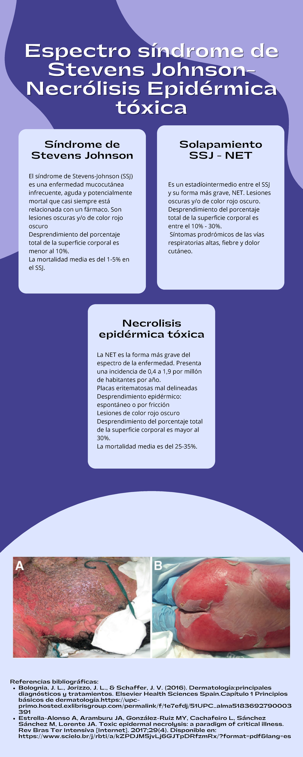 Espectro síndrome de Steven Johnson-Necrólisis Epidérmica tóxic A - El ...
