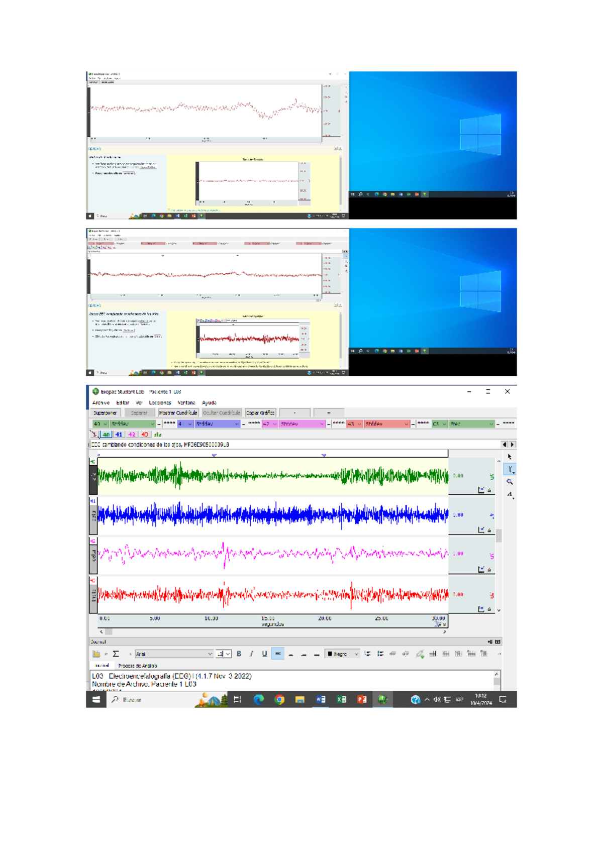 EEG-ELECTROENCEFALOGRAMA - REVISAR 200 REVISAR Biopac Student Lab ...