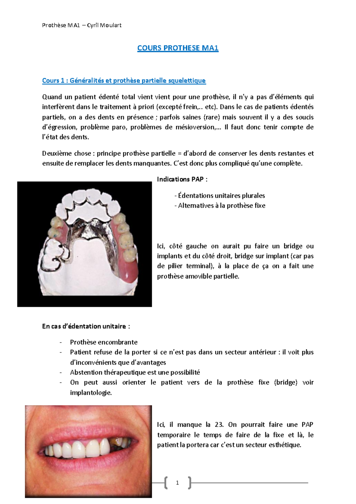Prothèse cyril - notes - COURS PROTHESE MA Cours 1 : Généralités et ...