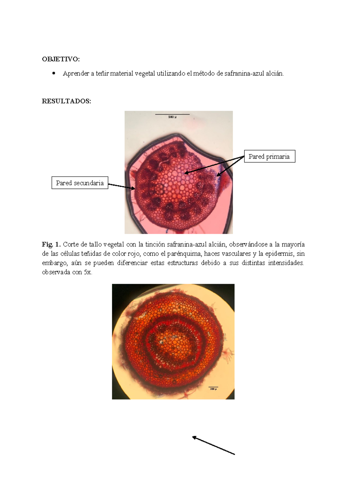 Práctica 3: Tinción de Tejidos Vegetales con Safranina y Azul Alcián ...