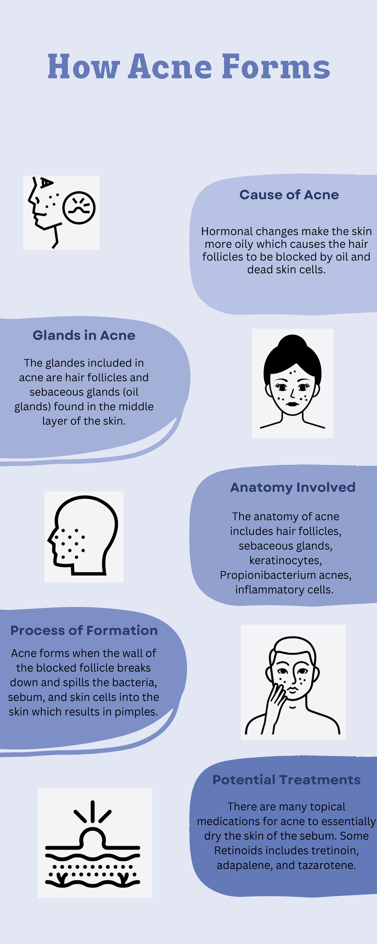 Acne Formation & Treatment Overview - Infographic Study - Studocu
