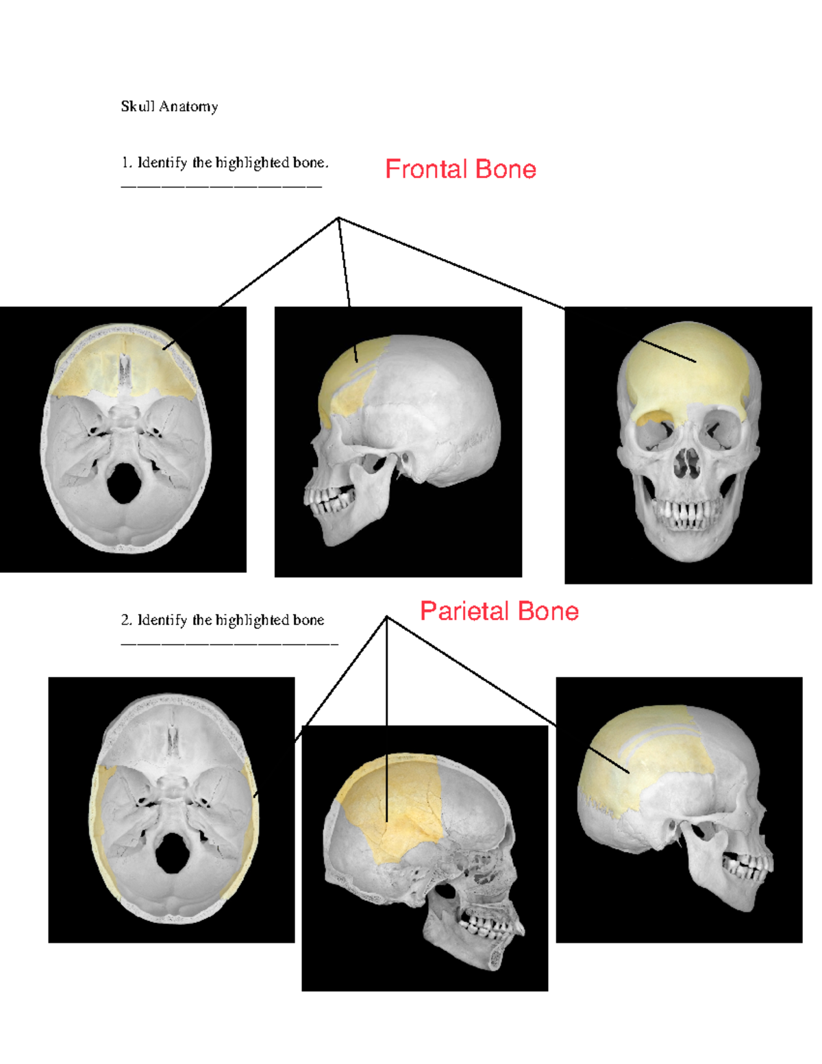 Skel skull anat stud - Skull Anatomy Identify the highlighted bone ...
