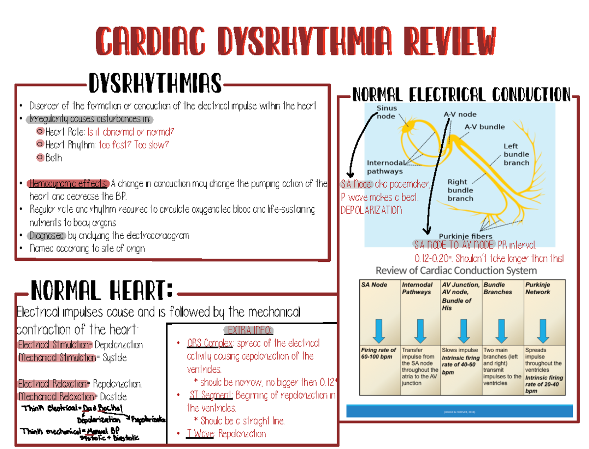 Cardiac Dysrhythmia Review Notes - Deprecated API usage: The SVG back ...
