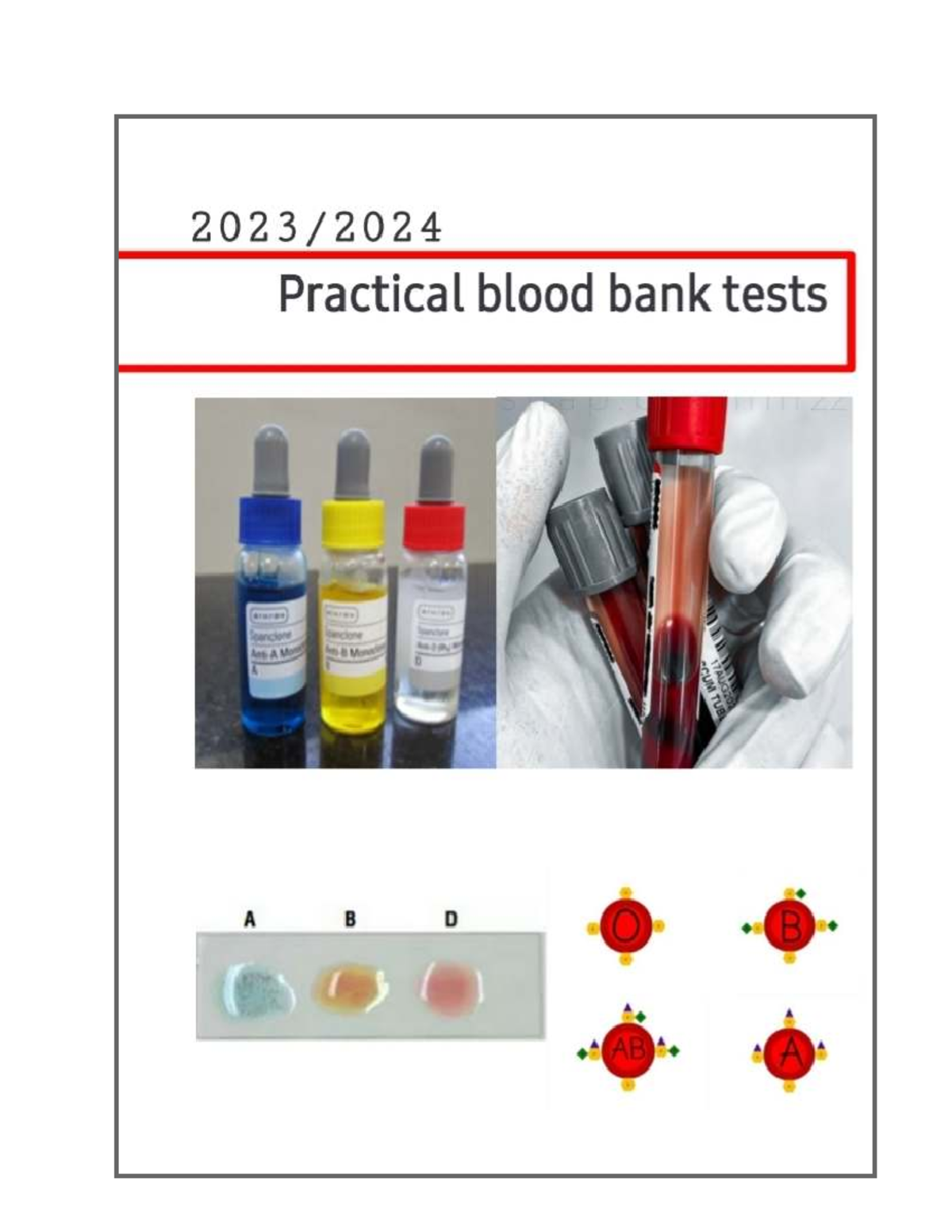 Practical Blood Bank Techniques: Normal Saline & Crossmatching - Studocu