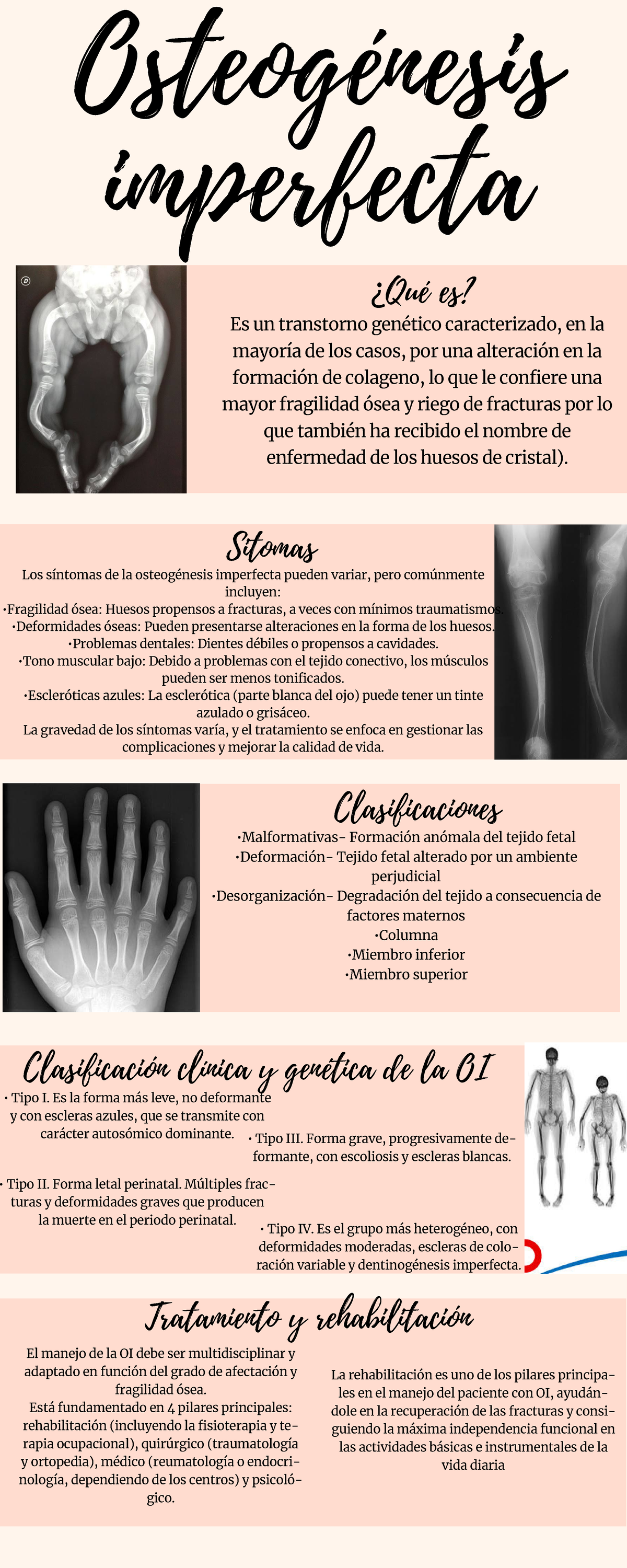 Infografía sobre Osteogénesis Imperfecta: Síntomas y Tratamiento - Studocu