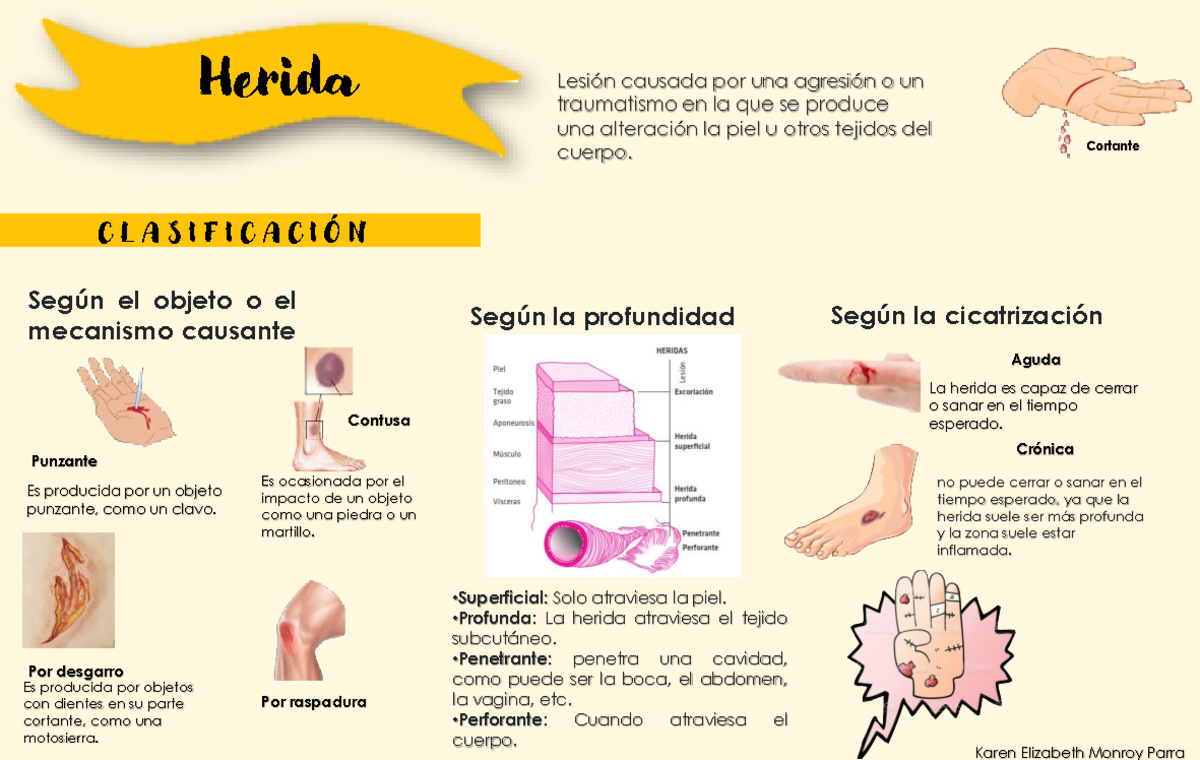 Infografía sobre tipos de heridas y fracturas - Curso de Salud - Studocu
