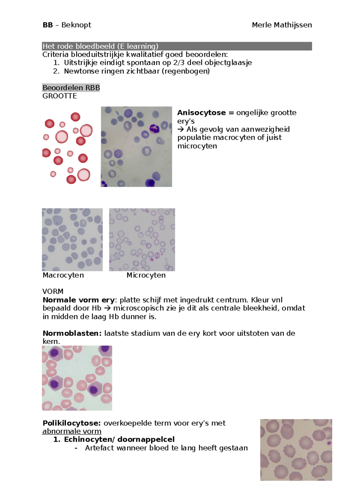 BB Bloedbeeld en Hematologie: Aanpak en Evaluatie van RBB - Studeersnel