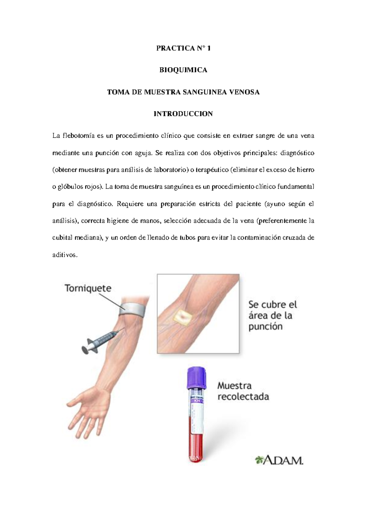 Práctica 1: Toma de Muestra Sanguínea Venosa en Bioquímica - Studocu