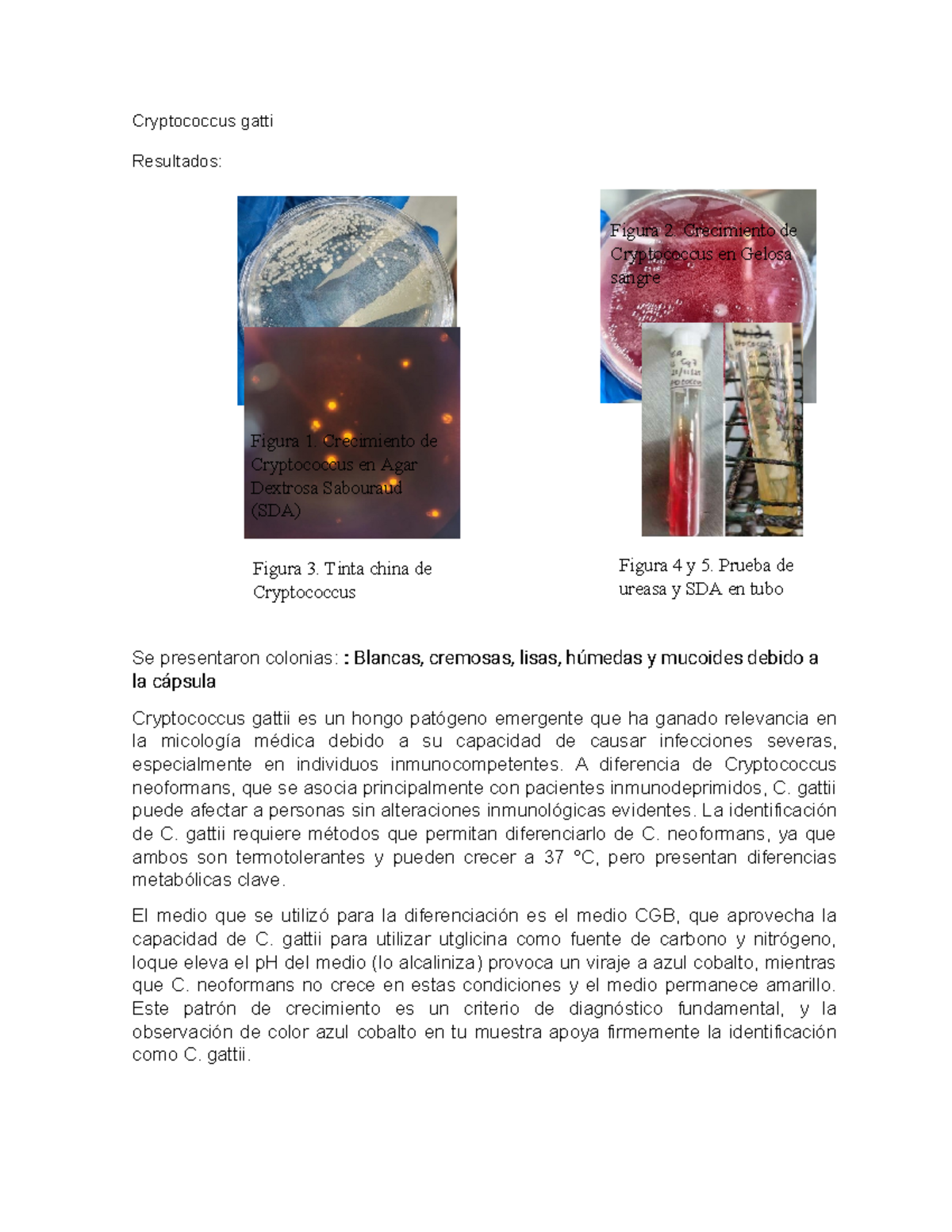 Resultados de Crecimiento y Diagnóstico de Cryptococcus gattii - Studocu