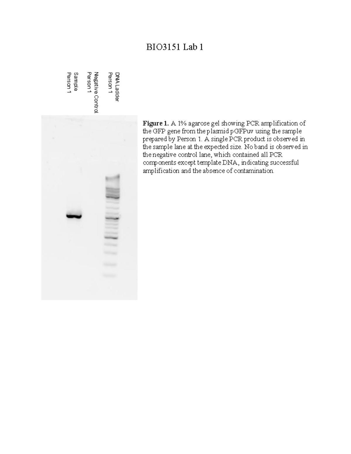 BIO3151 Lab 1: PCR Amplification and Primer Design Analysis - Studocu