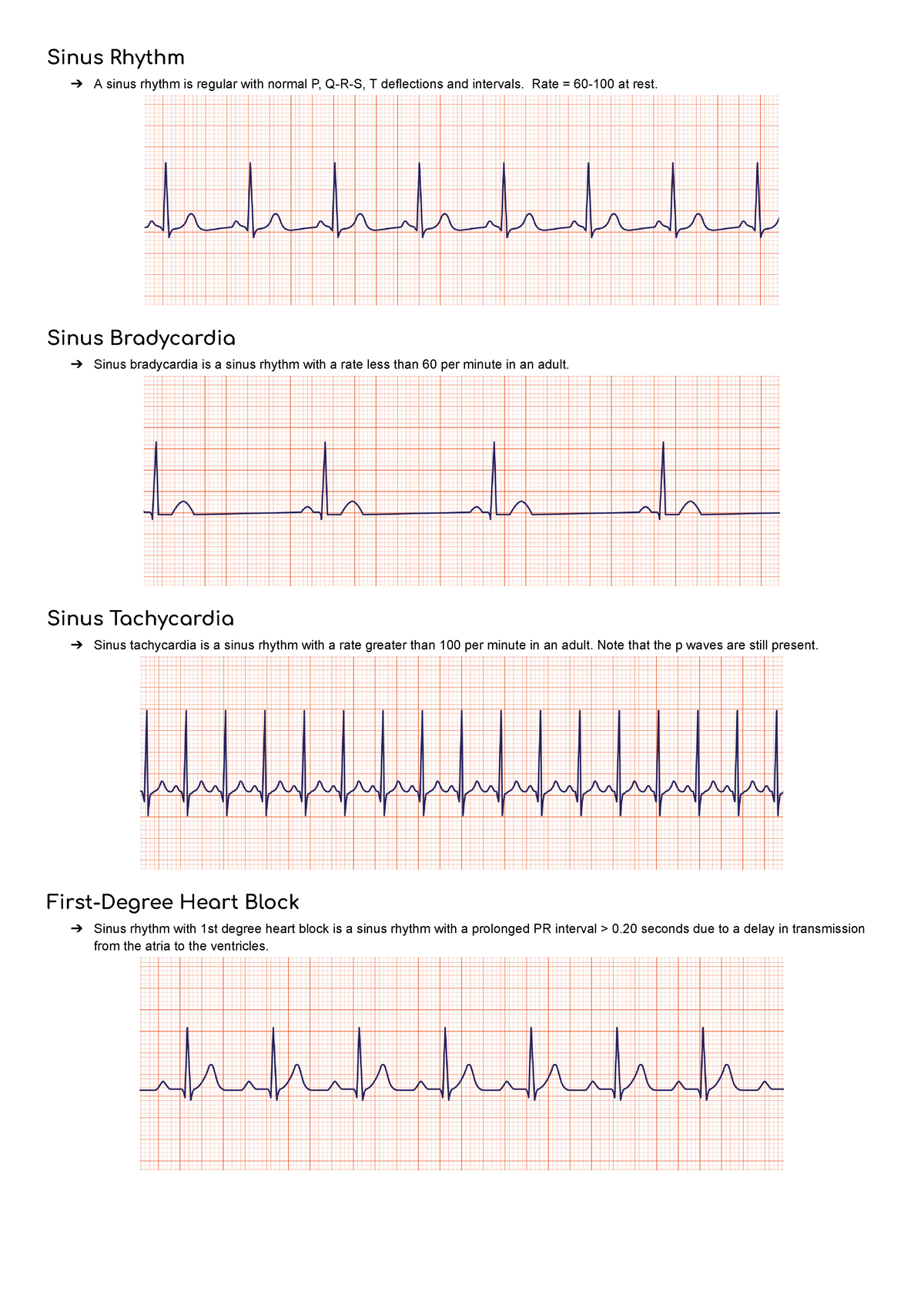 Types OF ECG Rhythms - The ECG is a fundamental procedure in cardiology ...