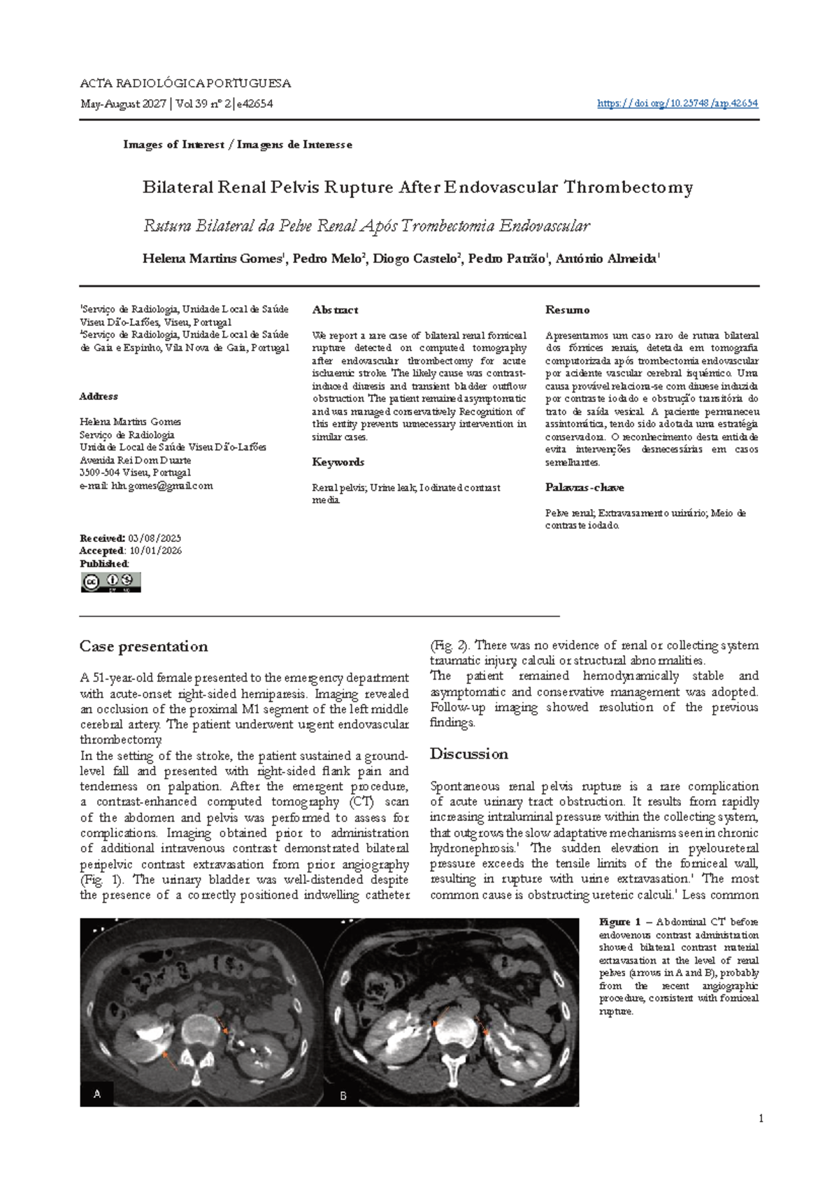ACTA RADIOLÓGICA PORTUGUESA 2027 Vol 39 nº 2 e42654: Bilateral Renal ...