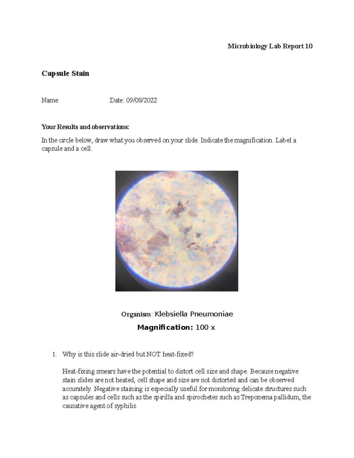 Microbiology Lab Report 10: Capsule Staining Techniques - Studocu