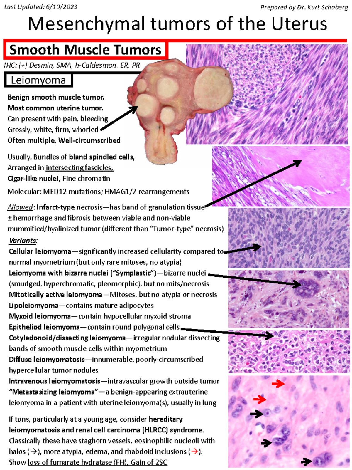 Uterus Mesenchymal Tumors: Pathology Overview and IHC Insights - Studocu
