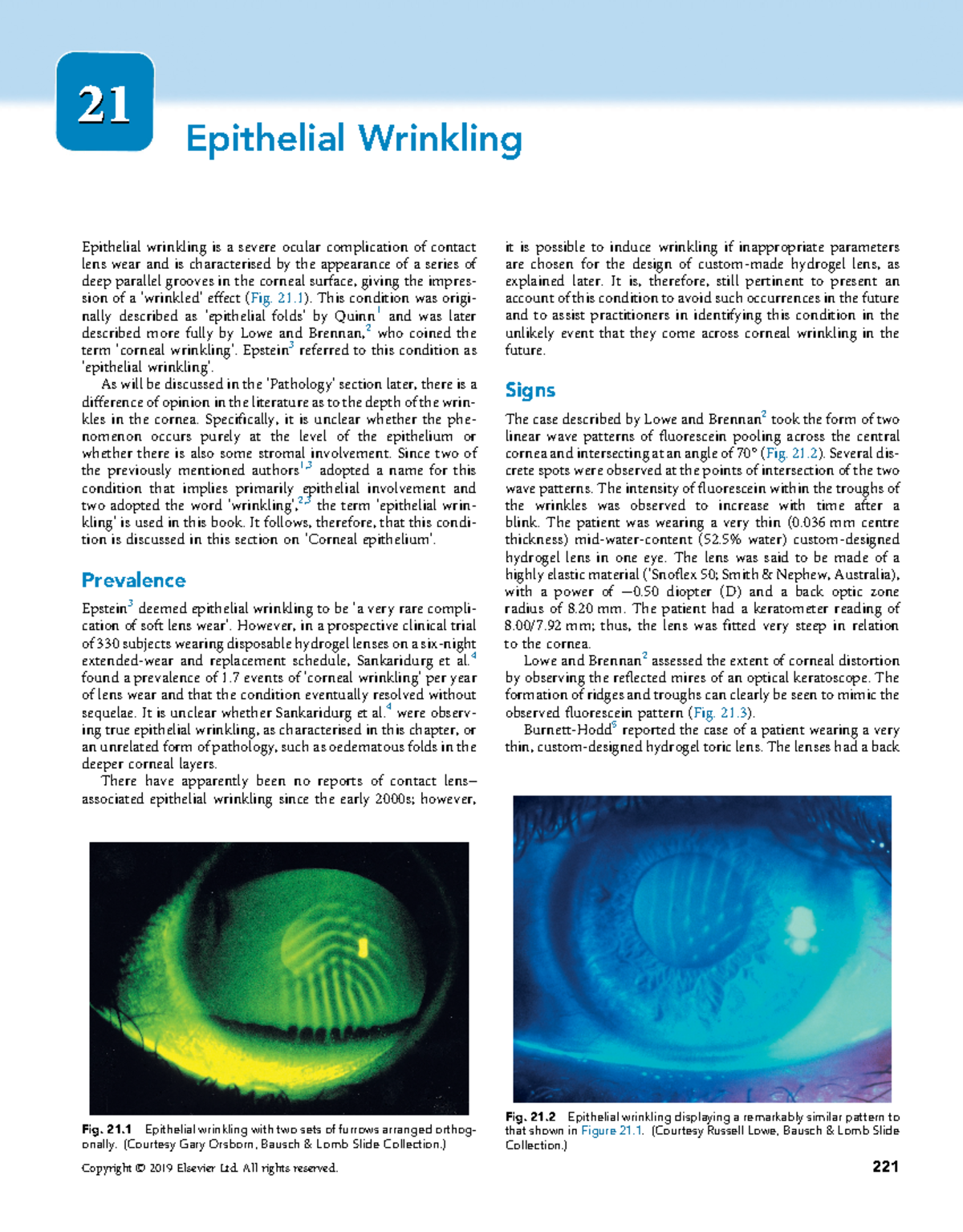 Epithelial Wrinkling Contact Lens Complications - 2121 Epithelial ...