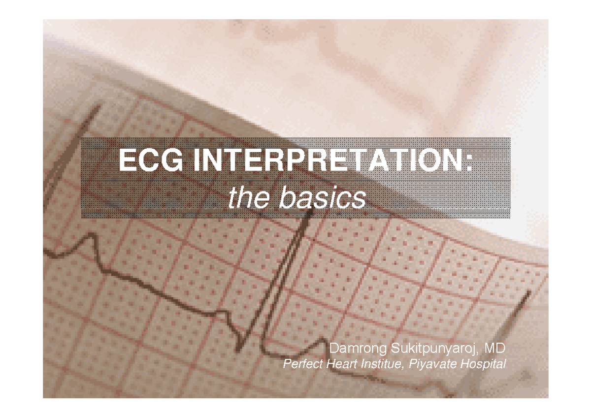 ECG INTERPRETATION: Basics & Common Abnormalities in Critical Care ...