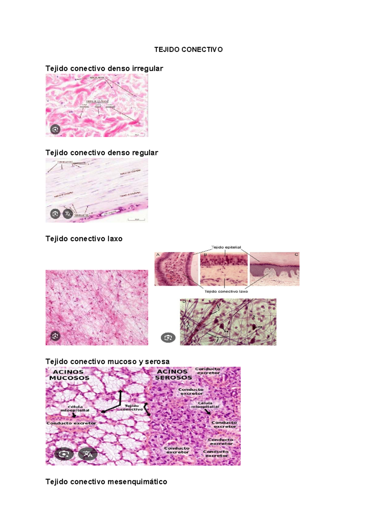 Tejido Conectivo Y Epitelial Glandular - TEJIDO CONECTIVO Tejido ...