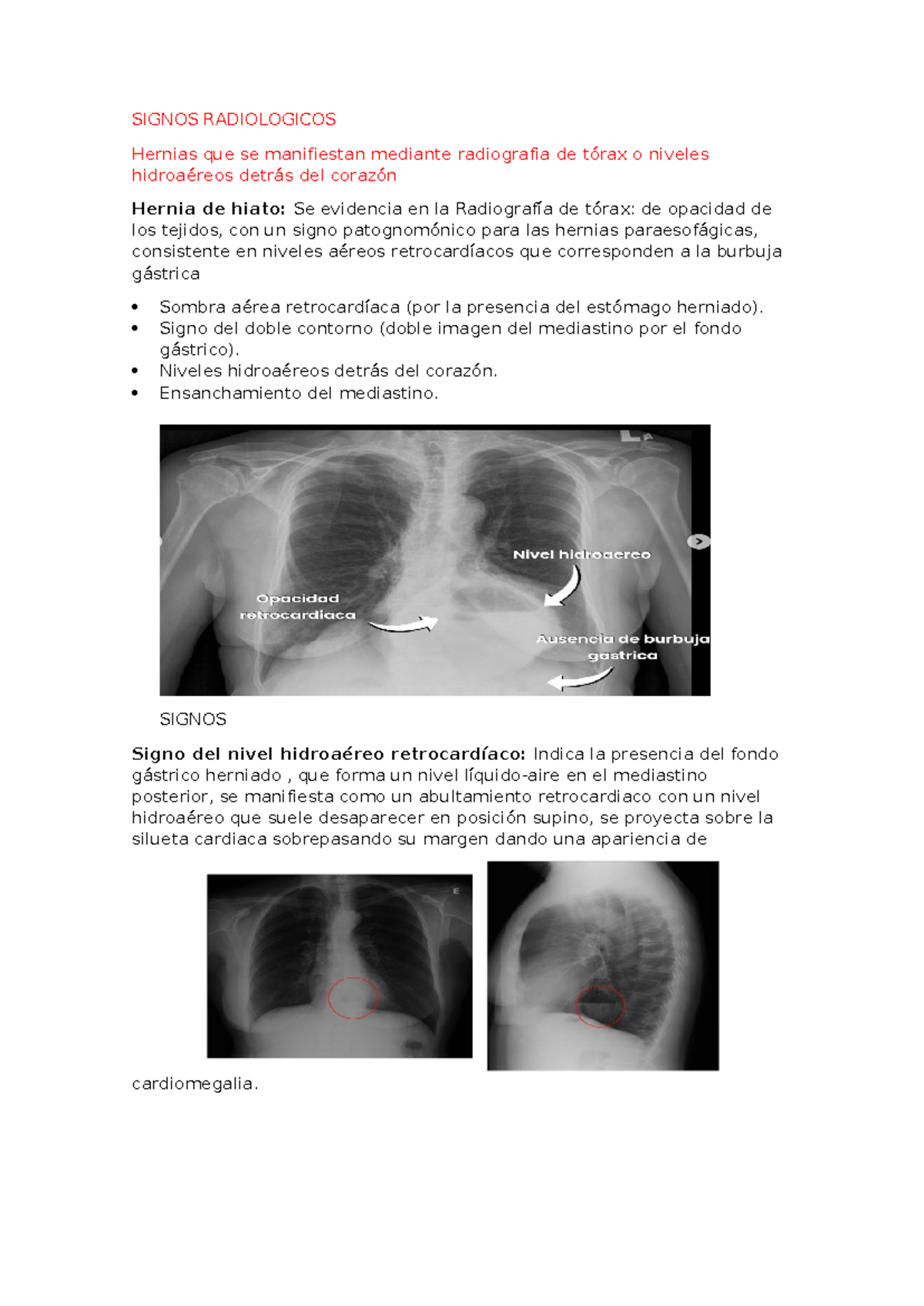 SIGNOS RADIOLOGICOS: Hernia Hiatal en Radiografía de Tórax - Studocu