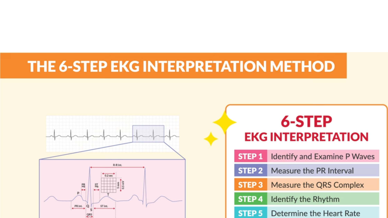 EKG interpretation - Notes from lecture - NUR 445 - THE EKG ...